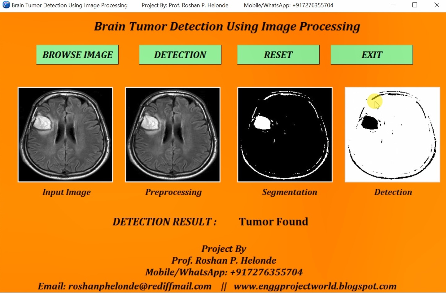 Brain Tumor Detection Using Image Processing Python Project With Source Code Ieee Based