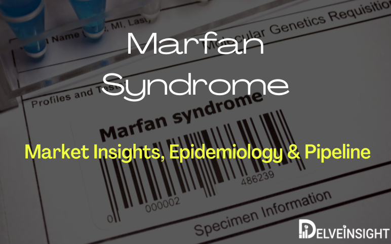 Marfan Syndrome Explained Unveiling The Genetic Enigma