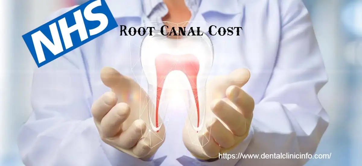 Root Canal Cost On Nhs Cost Of Root Canal On The Nhs Dental Clinic Info Best Dentist