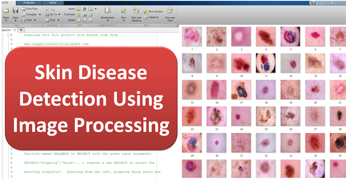Skin Disease Detection Using Image Processing Matlab Project With Source Code Final Year